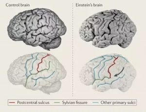 The Strange Story of Albert Einstein’s Brain After Death & The Key Findings